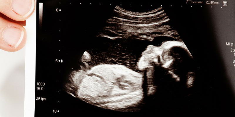 USG ginekologiczne – kiedy je wykonać i dlaczego warto? - KobietaMag.pl